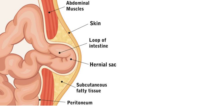 Umbilical Hernia In Cats Cat World